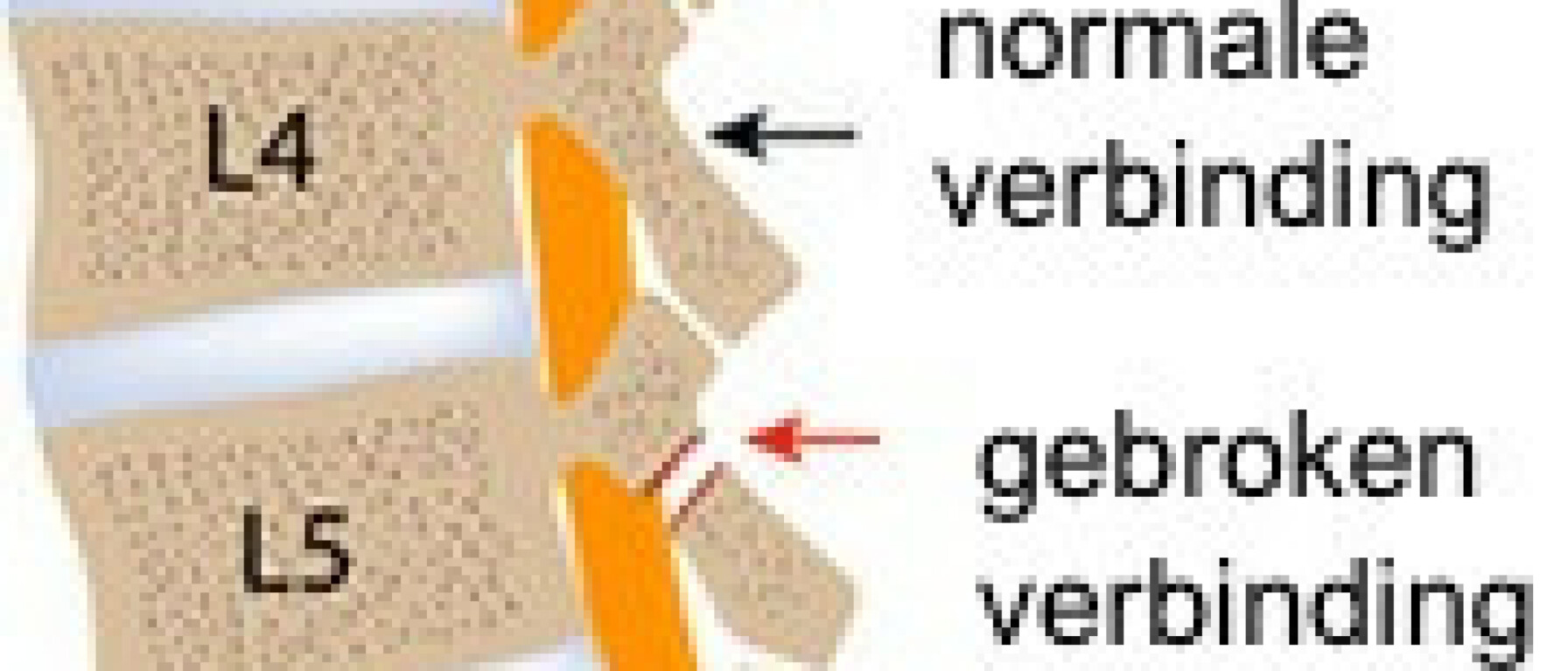 Alles over Postcommotioneel syndroom- behandeling