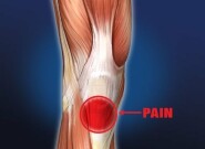 Kniepijnvrij: De 5 meest voorkomende overbelastingsblessures van de knie