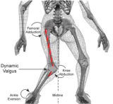 Dit zijn de 5 oorzaken van pijn in jouw knie