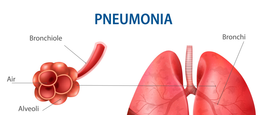 Wat zijn Bronchiolen?