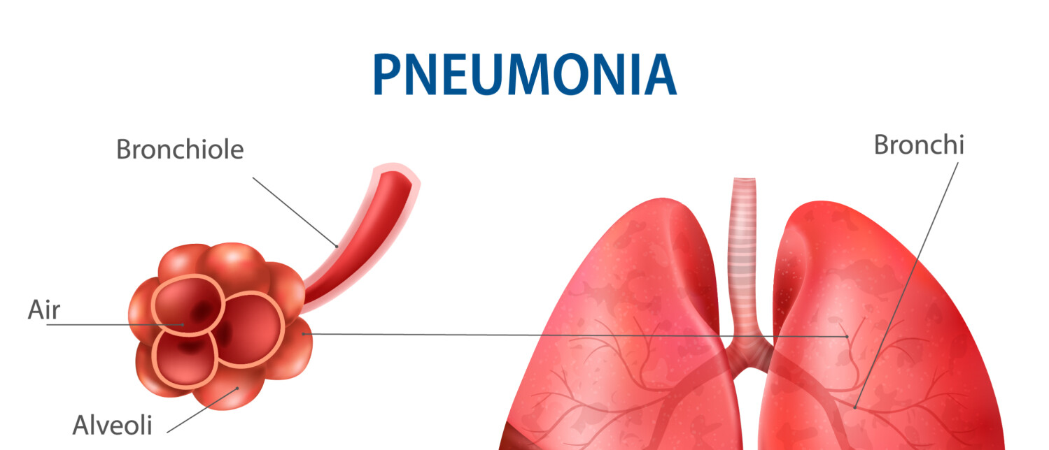 Wat zijn Bronchiolen?