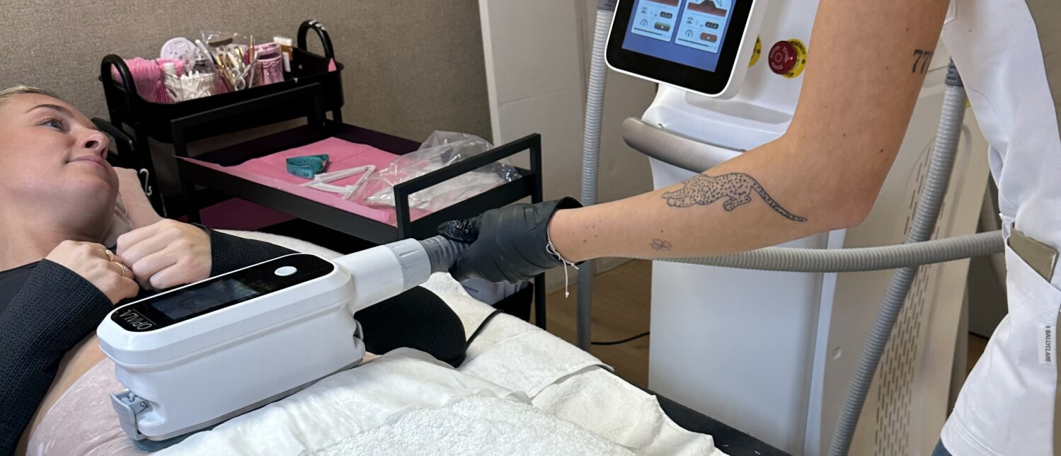 Cryolipolyse na 1 behandeling: Resultaat, voor en na & ervaringen