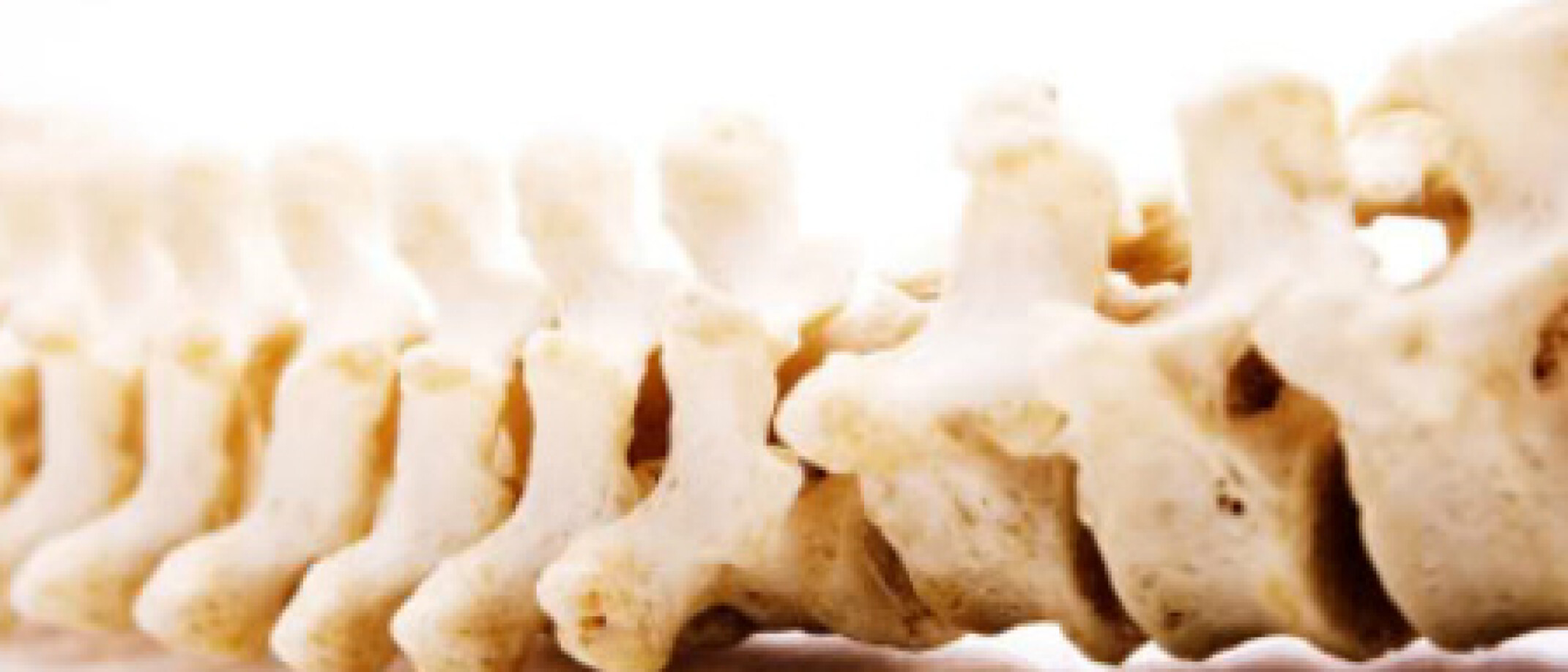 Scoliose behandeling, symptomen en tips