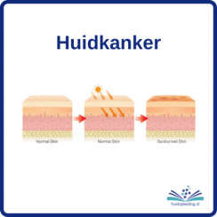 Cursus huidkanker | Huidopleiding.nl