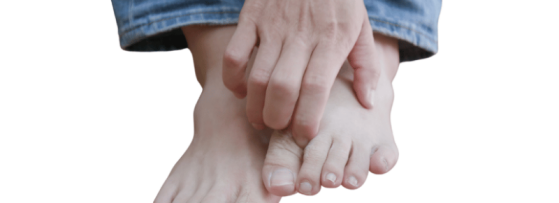 Voetschimmel | Jeuk onder voeten | Oplossing | Sproet