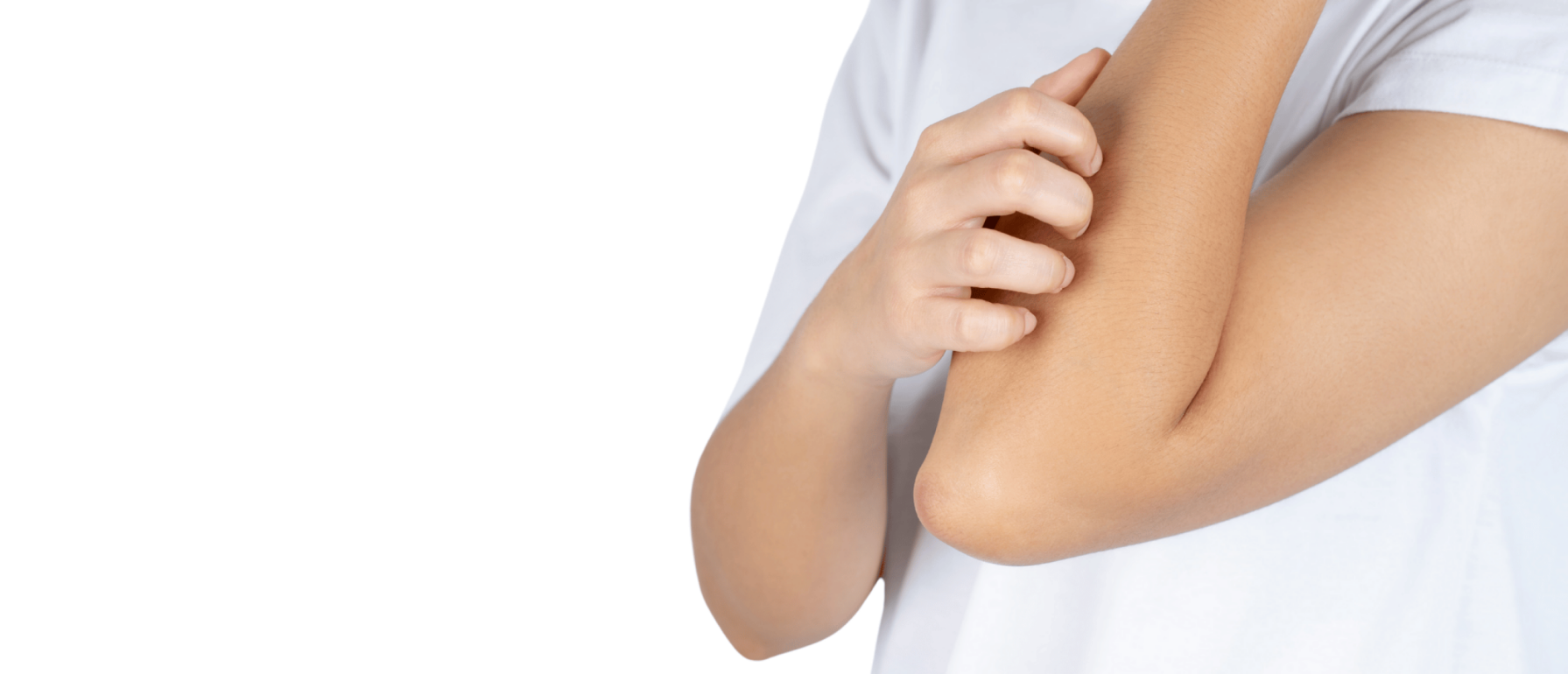 Jeuk over hele lichaam zonder uitslag | Mijn tips als huidtherapeut