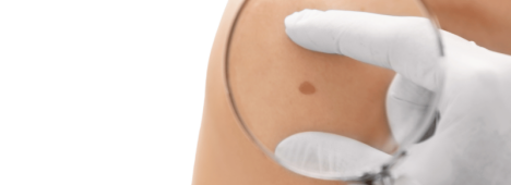 SkinVision app | Betrouwbaar of niet? | Mijn mening als huidtherapeut