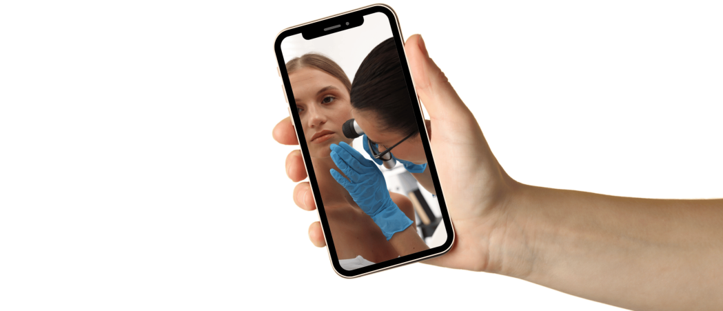 SkinVision app | Betrouwbaar of niet? | Mijn mening als huidtherapeut
