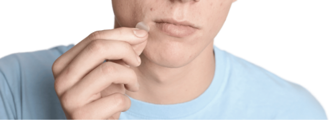 Pimple patches | Werken ze echt? | Sproet