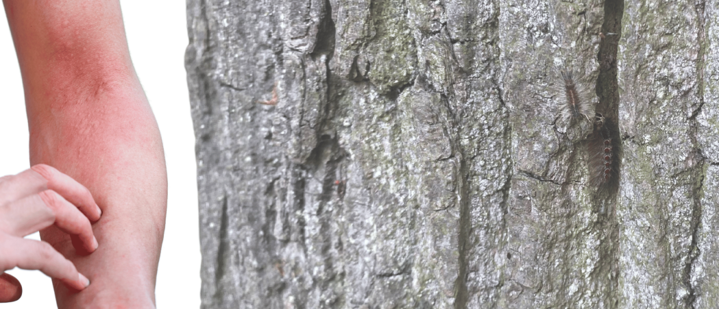 Huidproblemen door insecten | Oorzaak en tips | Sproet