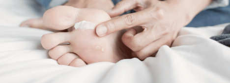 Voetschimmel | Jeuk onder voeten | Oplossing | Sproet