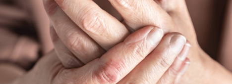 Eczeem handen | Oorzaak en oplossing | Sproet