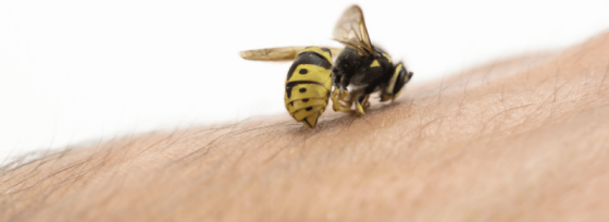 Insectenbeten en jeuk | Oorzaak en tips | Sproet