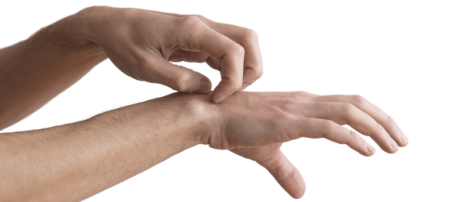 Handschimmel | Oplossing en behandeling | Sproet