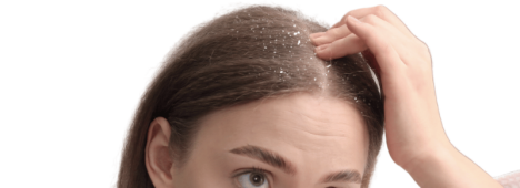 Hoofdhuid psoriasis | Oorzaak en tips | Sproet