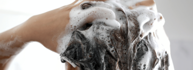 Hoofdhuid psoriasis | Oorzaak en tips | Sproet