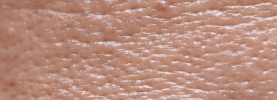 Grove poriën | Mijn tips als huidtherapeut