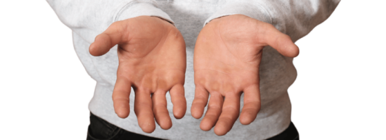 Eelt op hand | Oorzaak en tips | Sproet