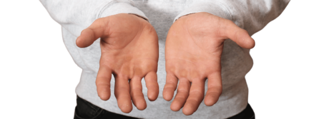 Eelt op hand | Oorzaak en tips | Sproet