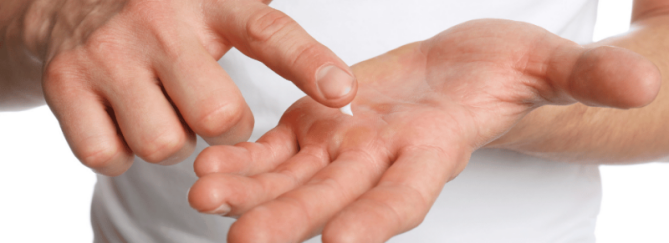 Eelt op hand | Oorzaak en tips | Sproet