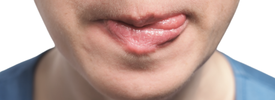 Liplik eczeem | Oorzaak en behandeling | Sproet