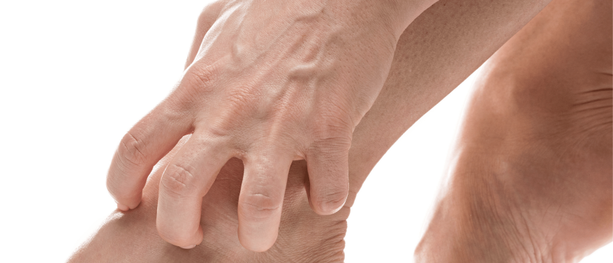 Jeukende benen | Oorzaak en tips van een huidtherapeut | Sproet