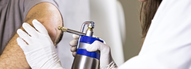 Cryotherapie | Alles wat je moet weten | Sproet