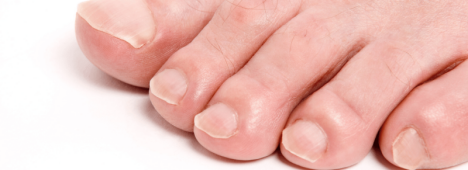 Wintertenen | Winterjeuk aan de tenen | Sproet