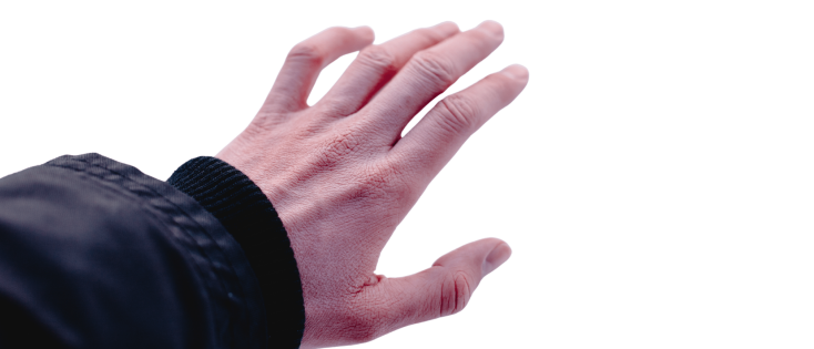 Winterhanden | Winterjeuk handen | Sproet