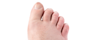 Wintervoeten | Winterjeuk voeten | Sproet