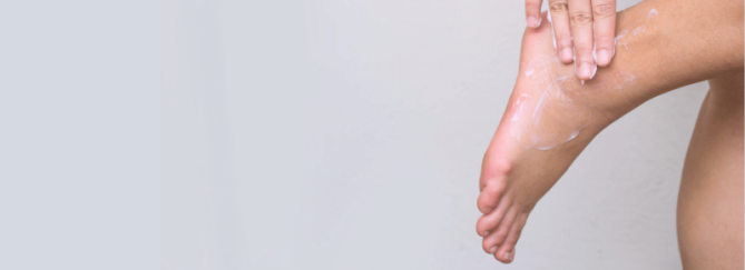 Wintervoeten | Winterjeuk voeten | Sproet