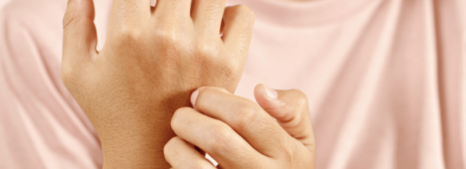 Winterhanden | Winterjeuk handen | Sproet