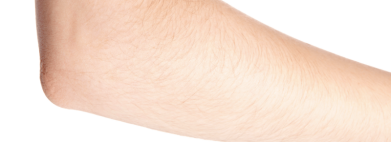 Ruwe huid | Oorzaak en oplossing | Sproet