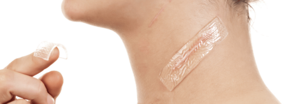 Hypertrofisch litteken | Oorzaak en behandelen | Sproet