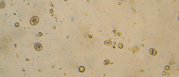 Eimeria-parasiet Coccidiose - Kippen Kennisbank - Kippenpakket.nl