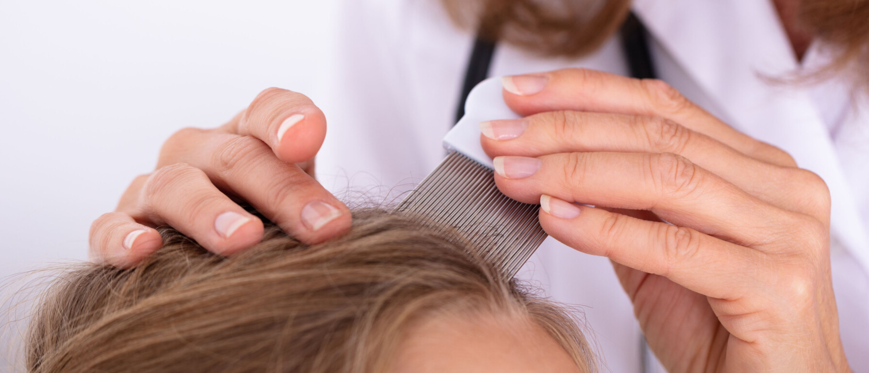 Hoofdluis | OptimumClinics