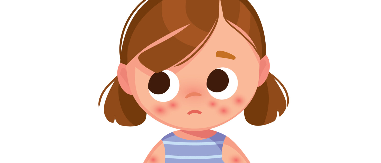 Wat zijn de symptomen van streptokokken?