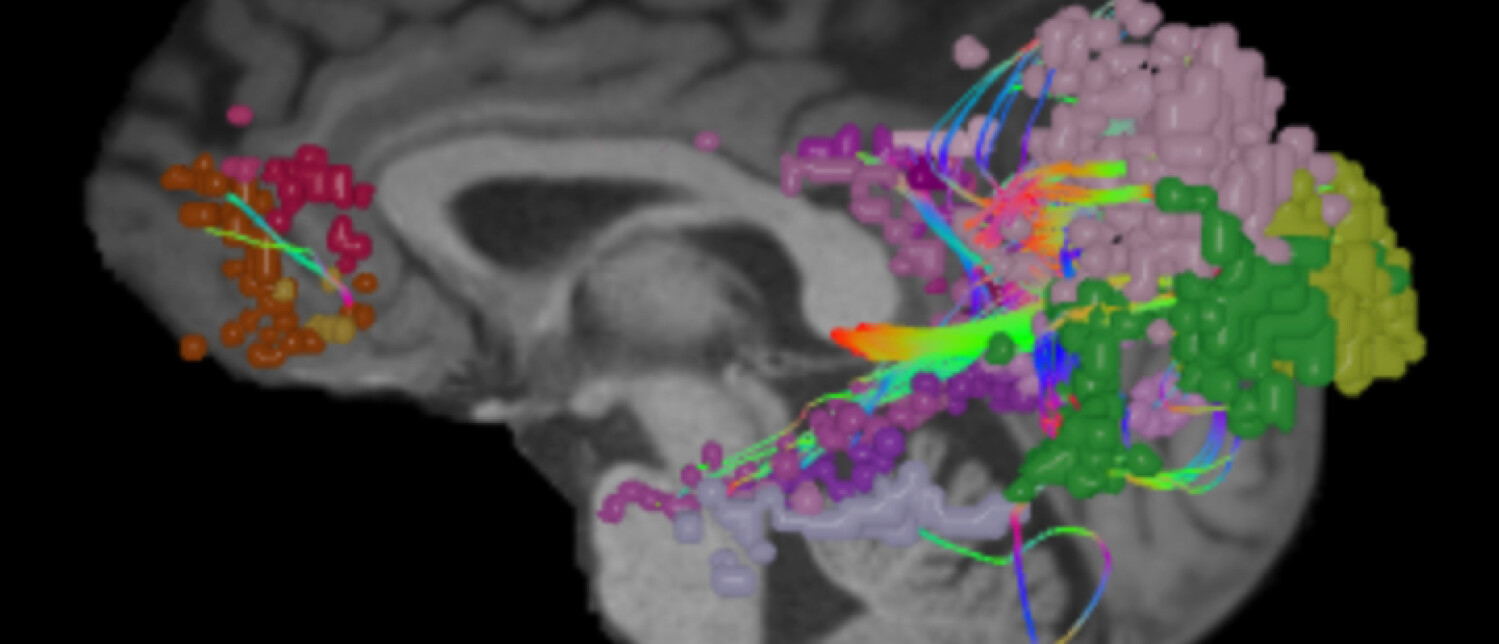 het default mode network in de praktijk