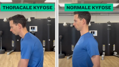 Kromme Rug? Wat te Doen?! | Door de Lage Rugpijn Fysio