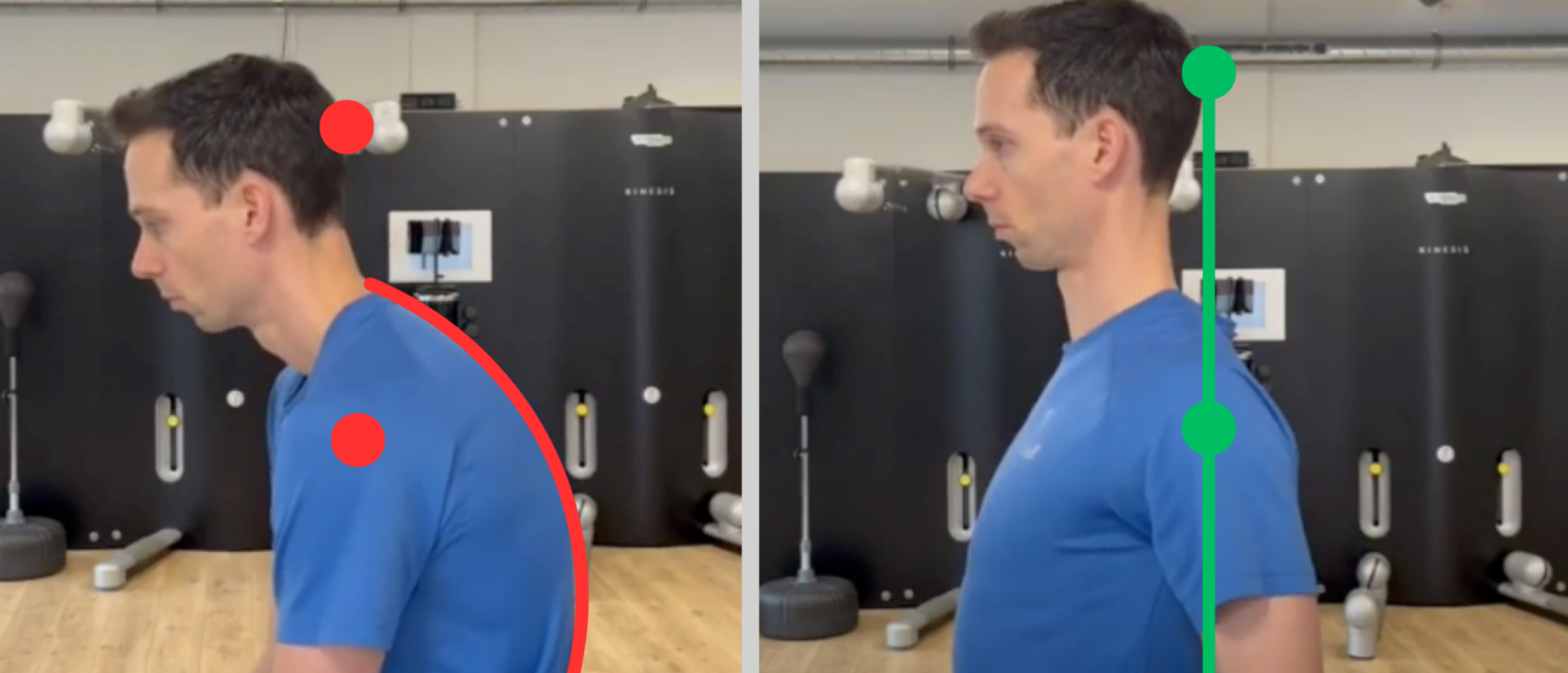 Kromme Rug? Wat te Doen?! | Door de Lage Rugpijn Fysio