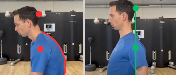 Kromme Rug? Wat te Doen?! | Door de Lage Rugpijn Fysio