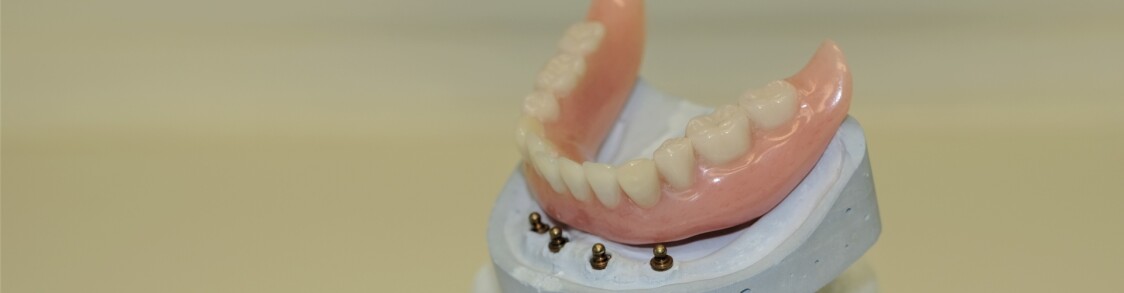 Klikgebit - passend & stralend | Leeseman Tandprotheticus