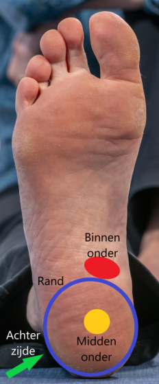 Hielpijn kan hielspoor zijn