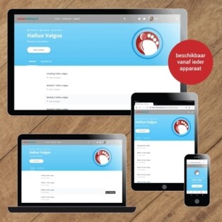 Kies je eigen Online Training Hallux valgus
