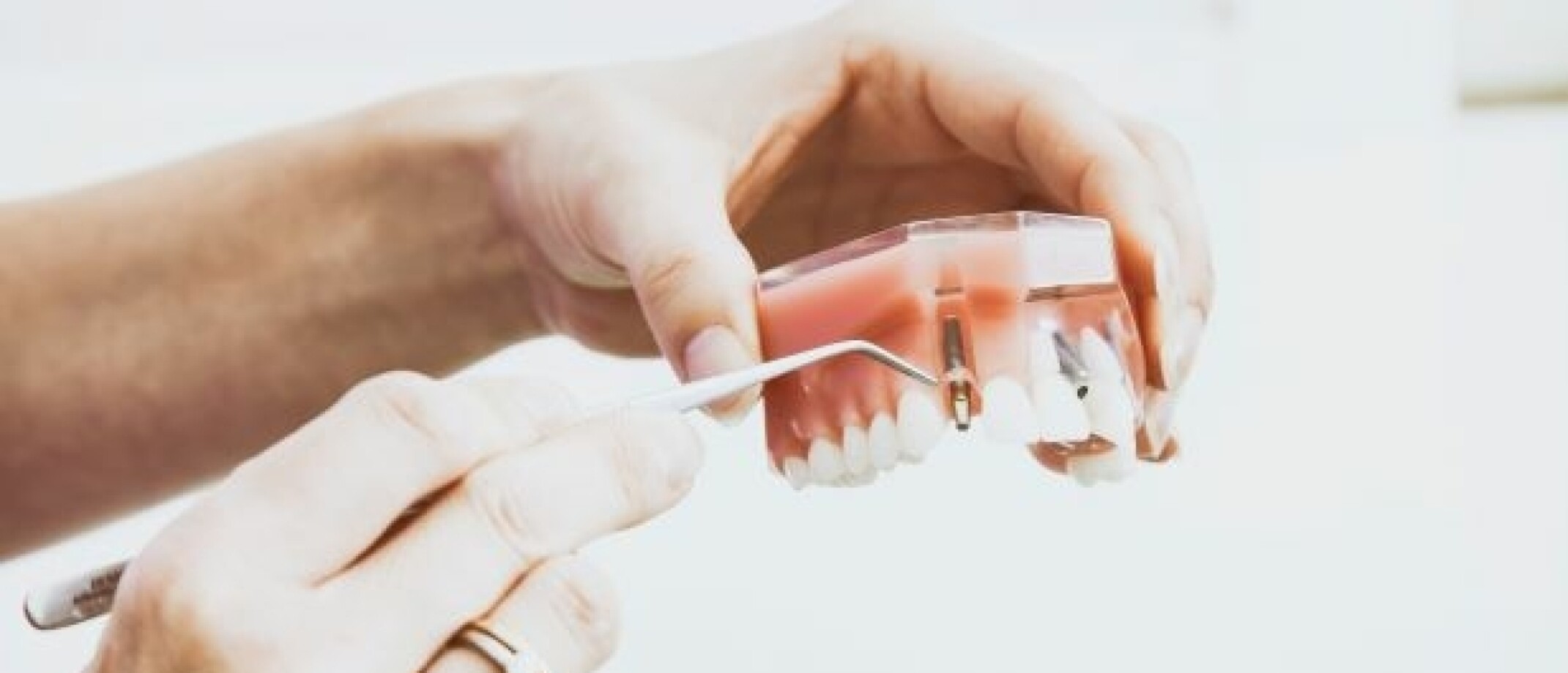 Het Klikgebit / de Klikprothese: Voordelen en Nadelen vanuit Patiënt ...