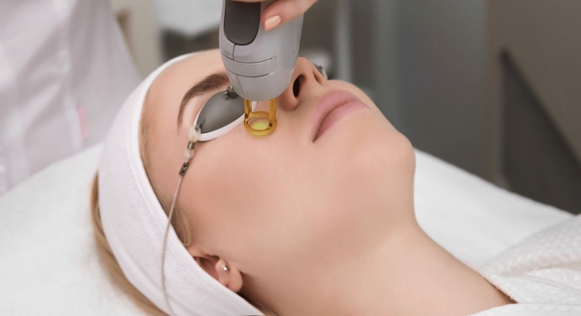 Huidverbetering met de CO2 Laser