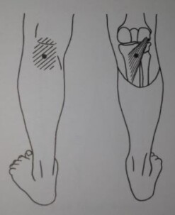 Alles over Triggerpoints in bovenbeen, hamstring knie