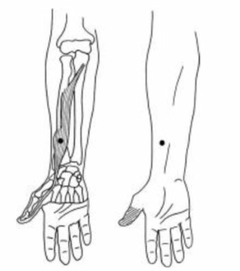 Triggerpoints arm, elleboog, pols, hand, duim en vingers ;de nummer 1 ...