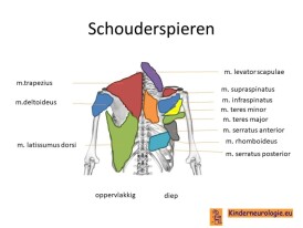 Alles over infraspinatus spier- behandeling klachten