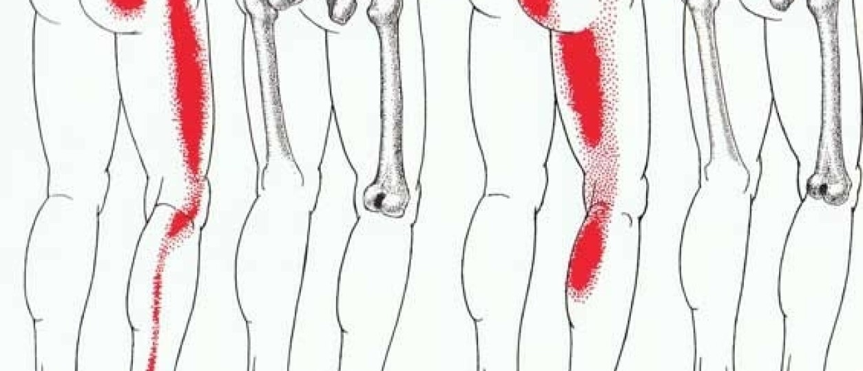 Beknelde zenuw in de nek, Oorzaak & Behandeling